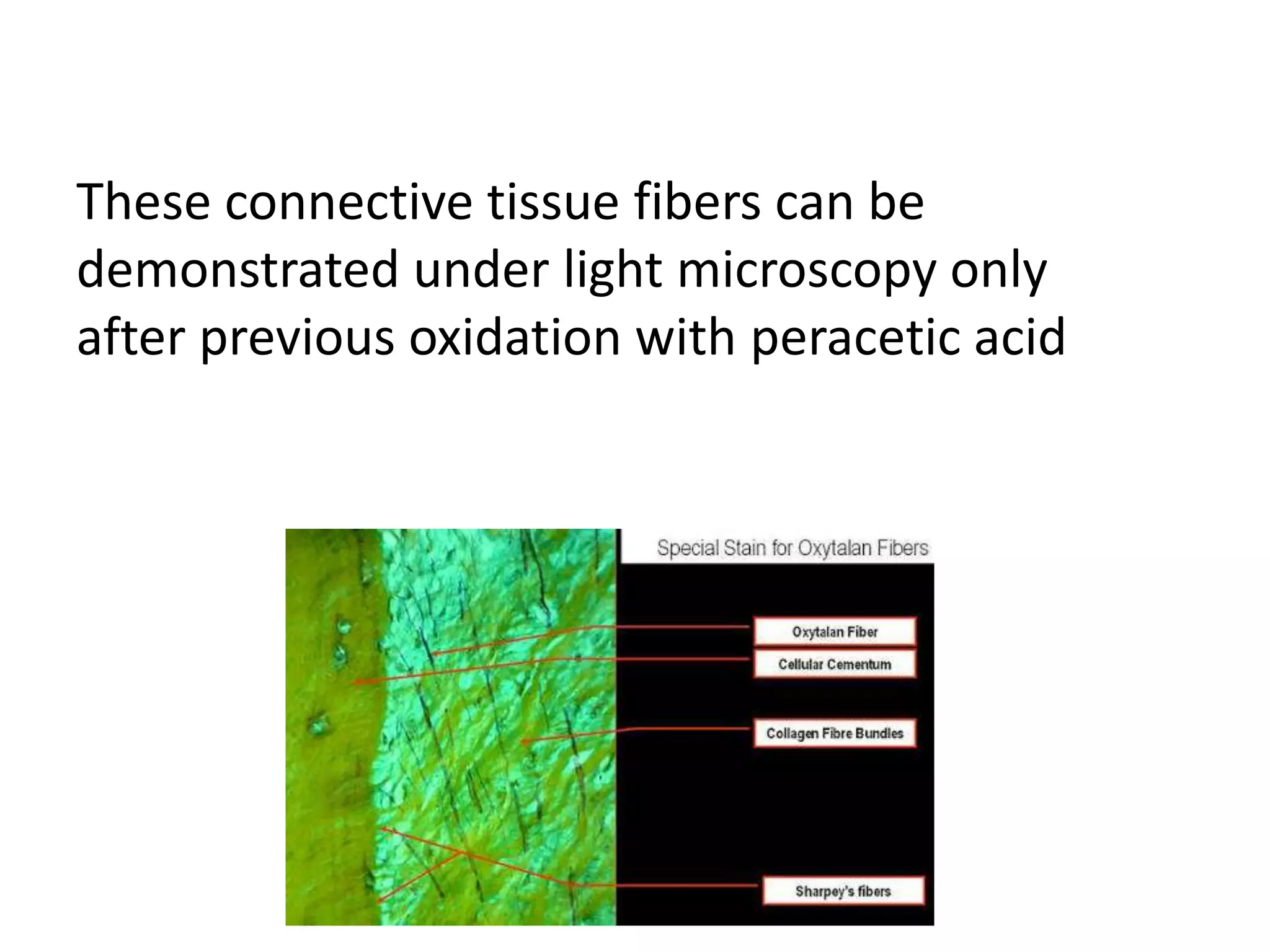 gingival connective tissue | PPTX