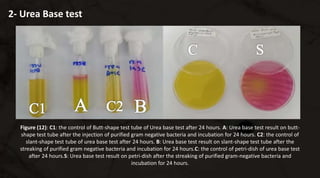 Antagonistic activity of some bacterial species against A. niger | PPT
