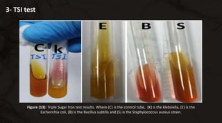 Antagonistic activity of some bacterial species against A. niger | PPTX