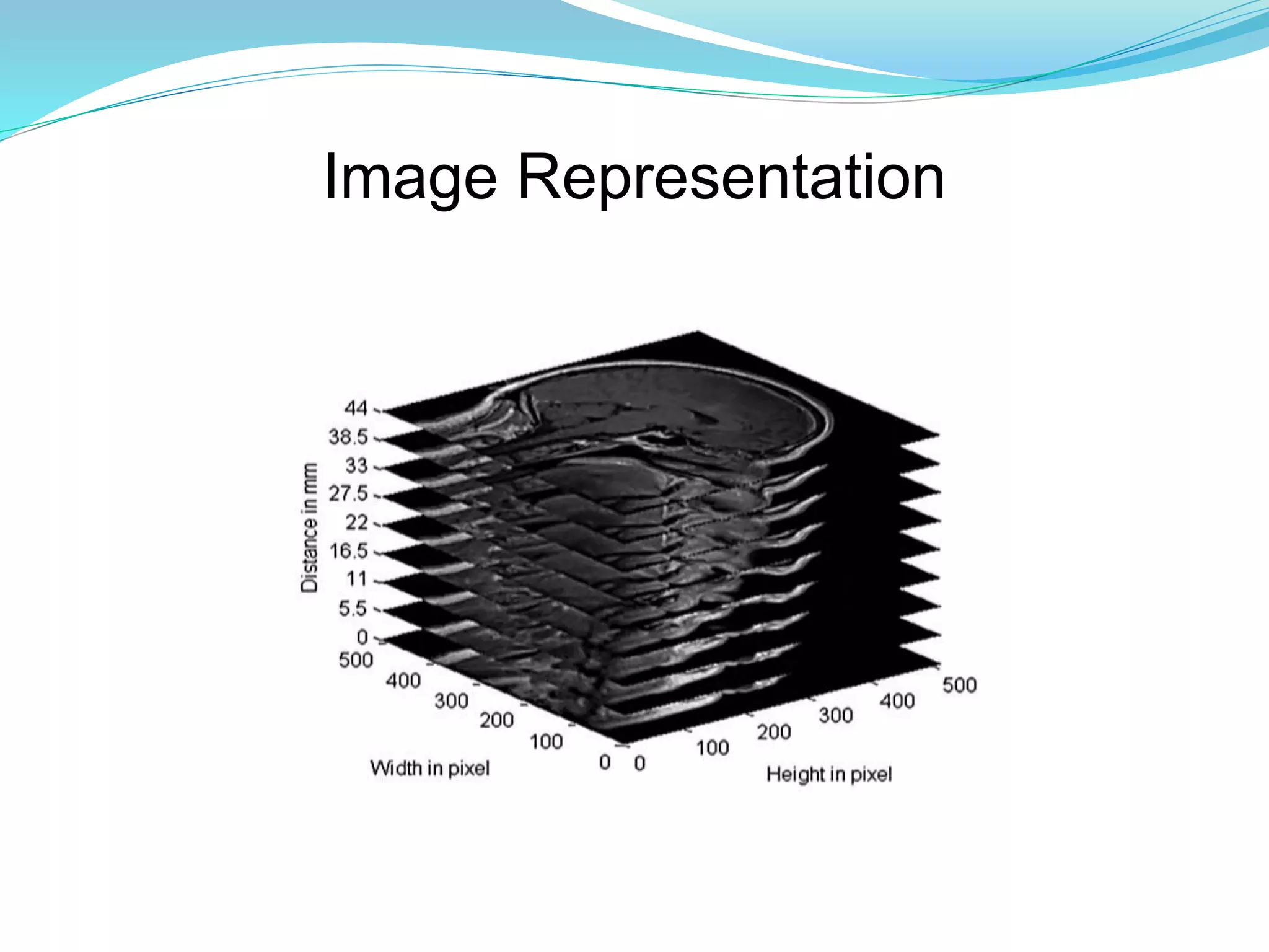 Automatic System For Detection And Classification Of Brain Tumors Ppt
