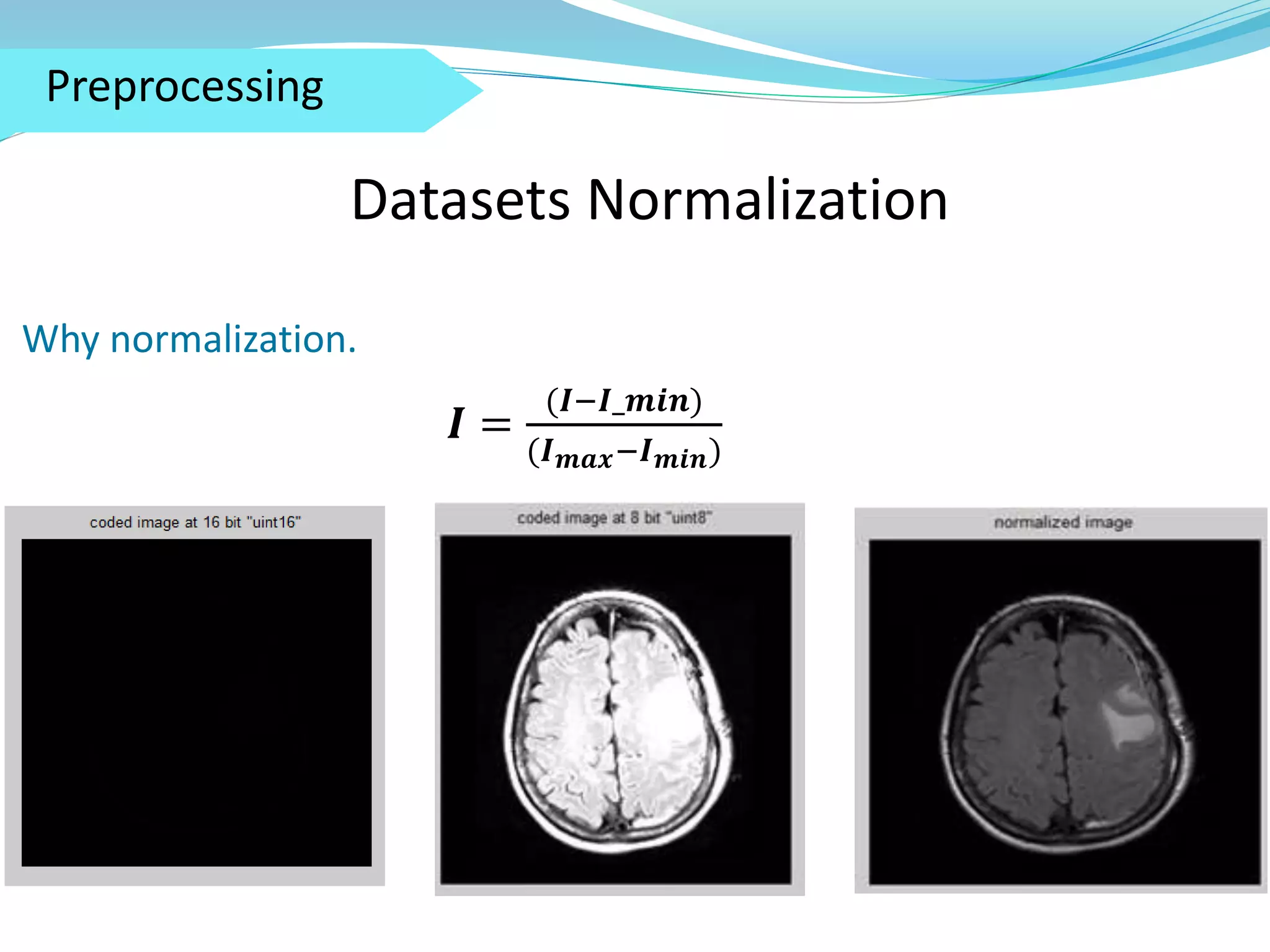 Automatic System For Detection And Classification Of Brain Tumors Ppt