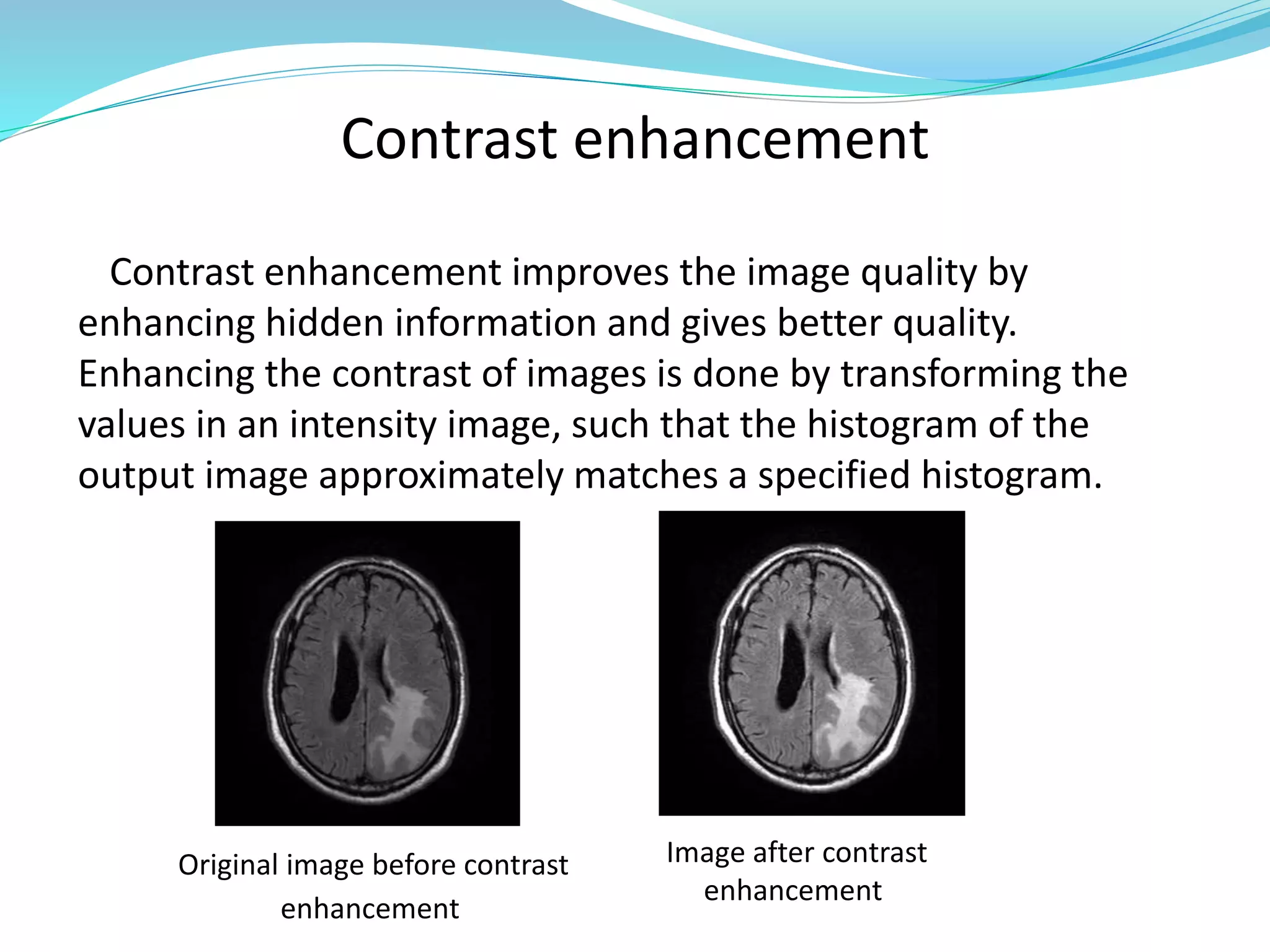 Automatic System For Detection And Classification Of Brain Tumors Ppt