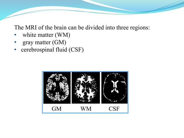 Automatic System For Detection And Classification Of Brain Tumors Ppt