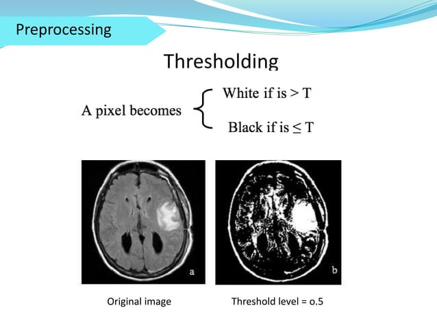 Automatic System For Detection And Classification Of Brain Tumors Ppt
