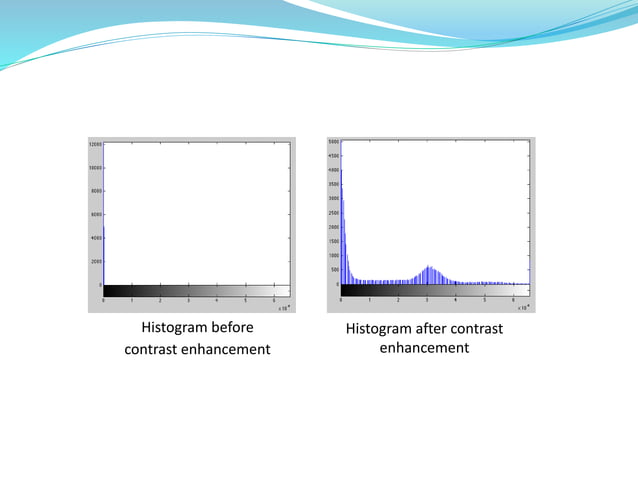 Automatic System For Detection And Classification Of Brain Tumors Ppt