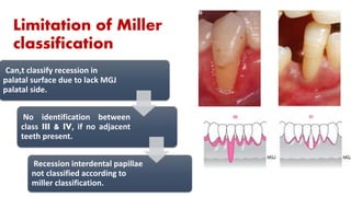 Art of predicting root coverage in localized gingival recession | PDF