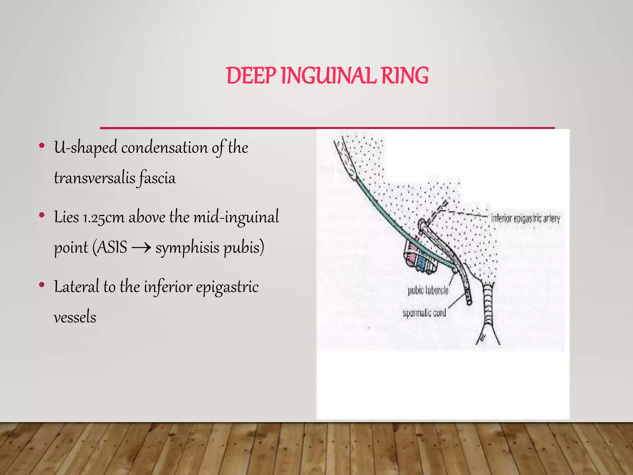 INGUINAL HERNIA HERNIA.ppt