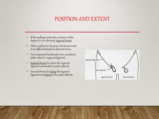 INGUINAL HERNIA HERNIA.ppt