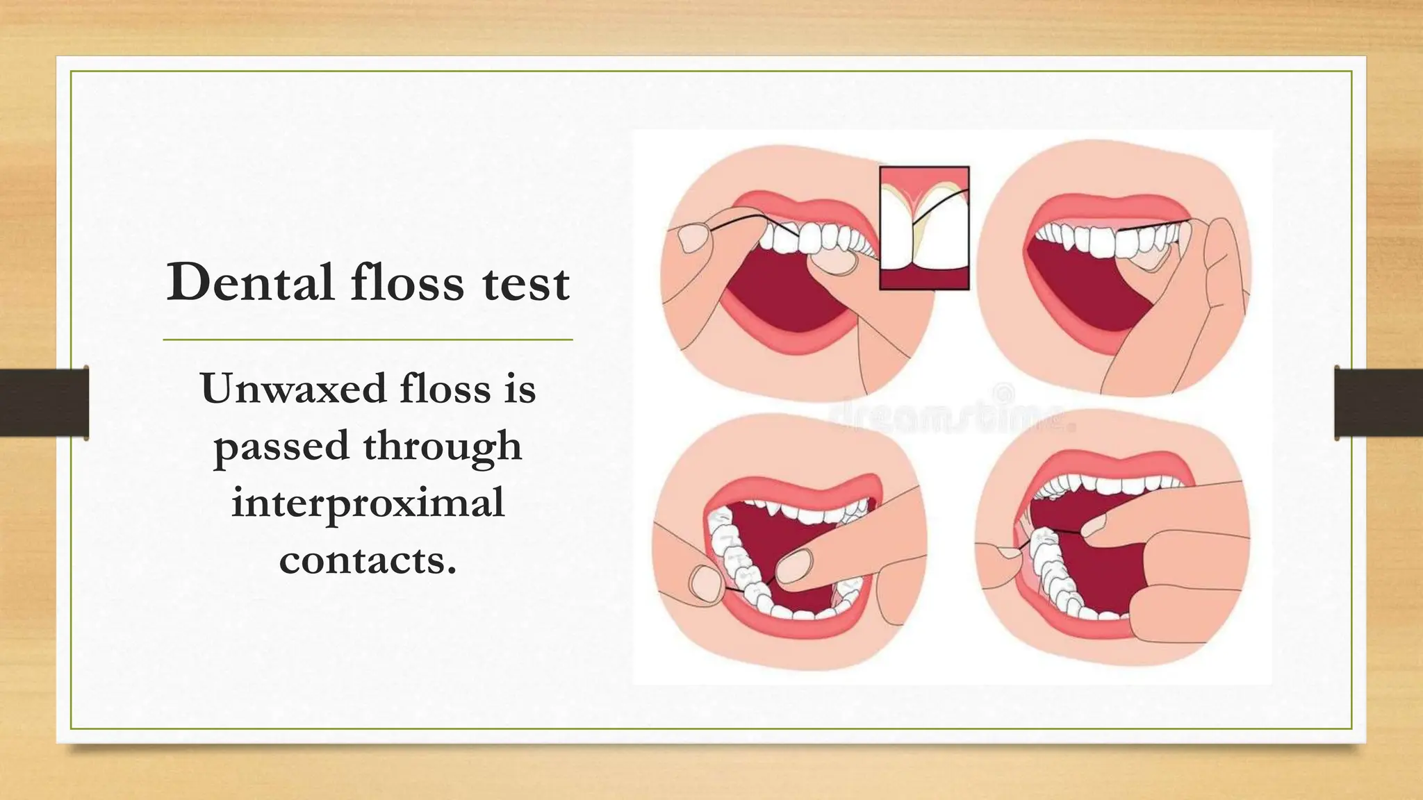 HALITOSIS_ diagnosis and management of halitosis | PPTX