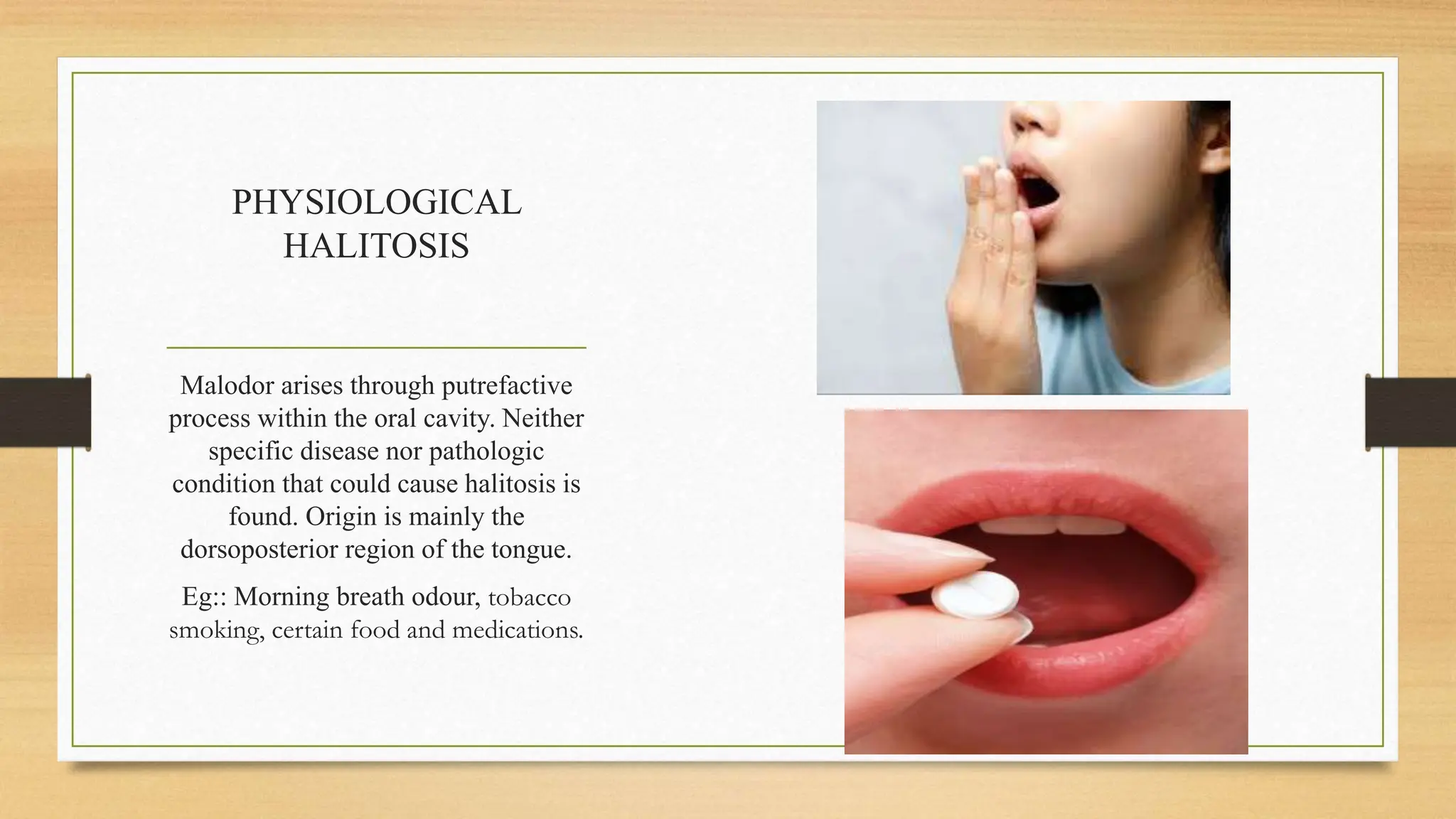 HALITOSIS_ diagnosis and management of halitosis | PPTX