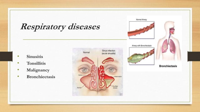 HALITOSIS_ diagnosis and management of halitosis | PPTX | Ear, Nose and ...