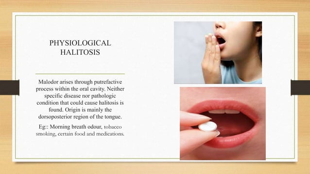 HALITOSIS_ diagnosis and management of halitosis | PPTX | Ear, Nose and ...