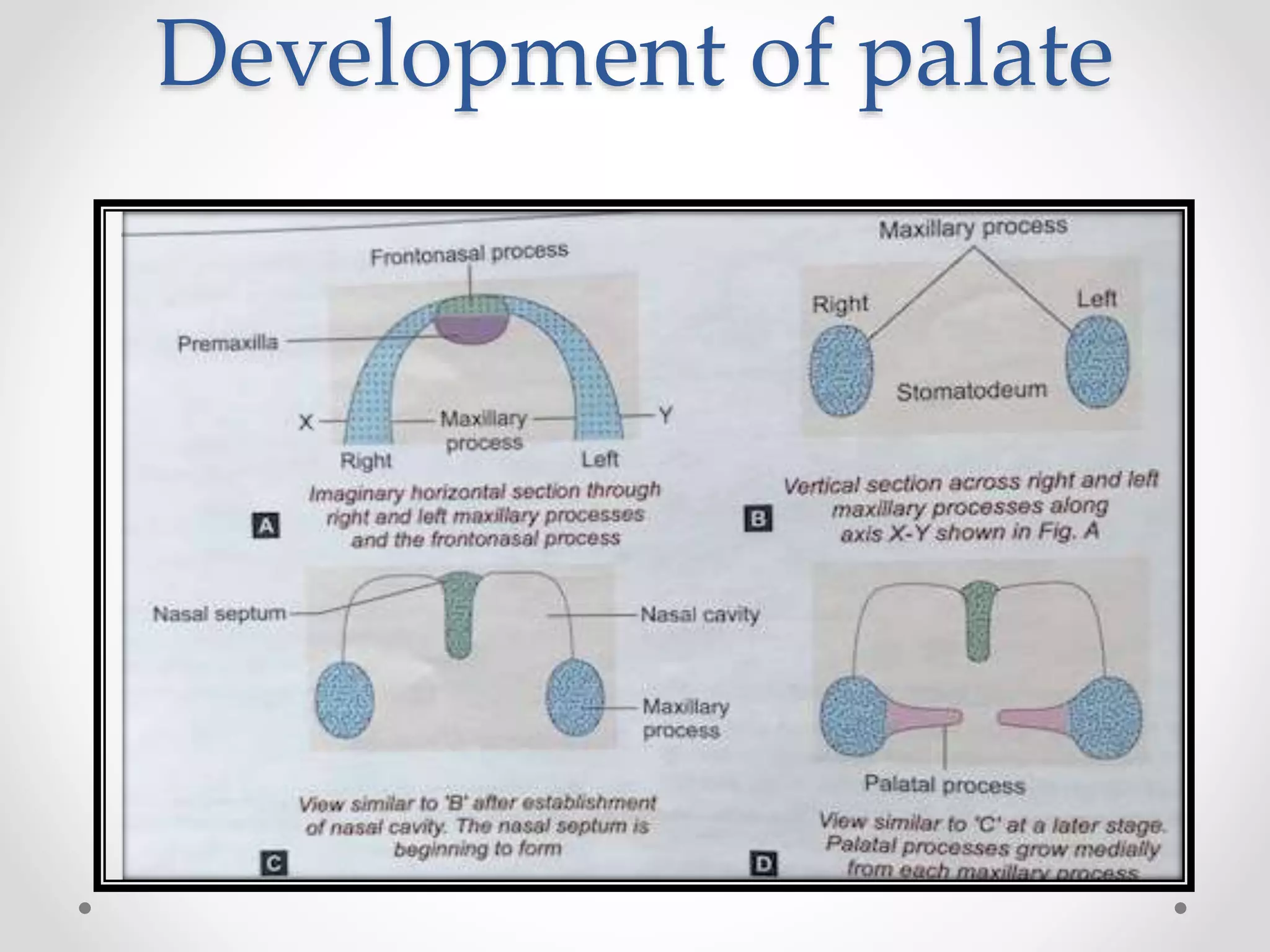 hard and soft palate | PPTX