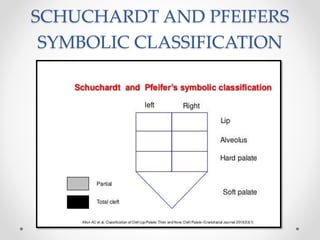 hard and soft palate | PPTX