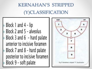 hard and soft palate | PPTX