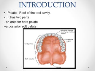 hard and soft palate | PPTX