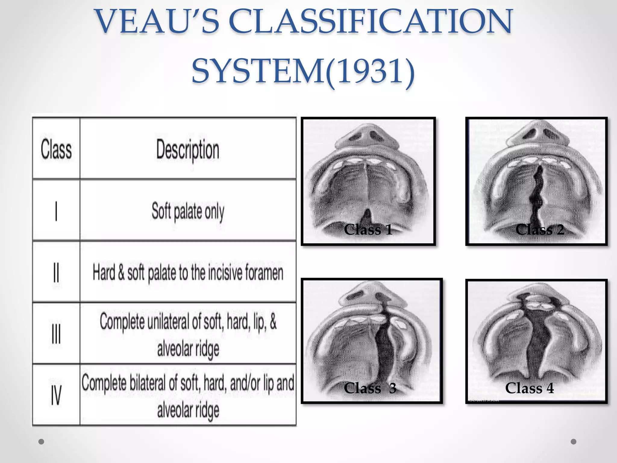 hard and soft palate in prosthodontics | PPTX