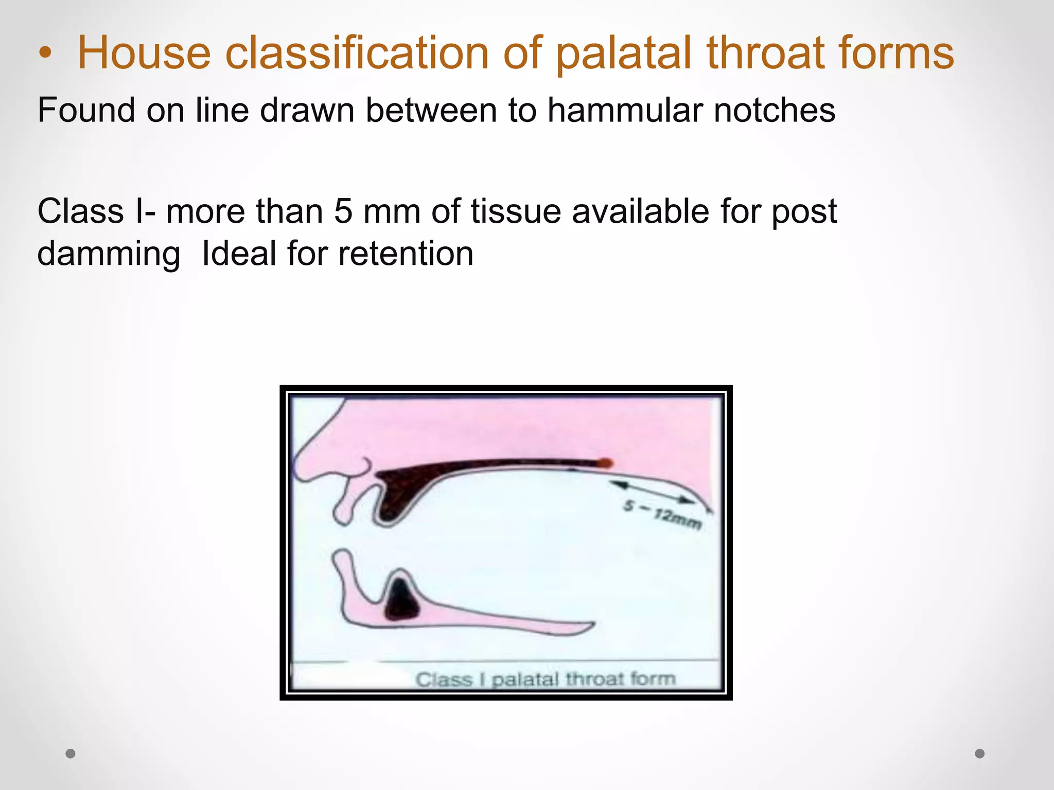 hard and soft palate in prosthodontics | PPTX