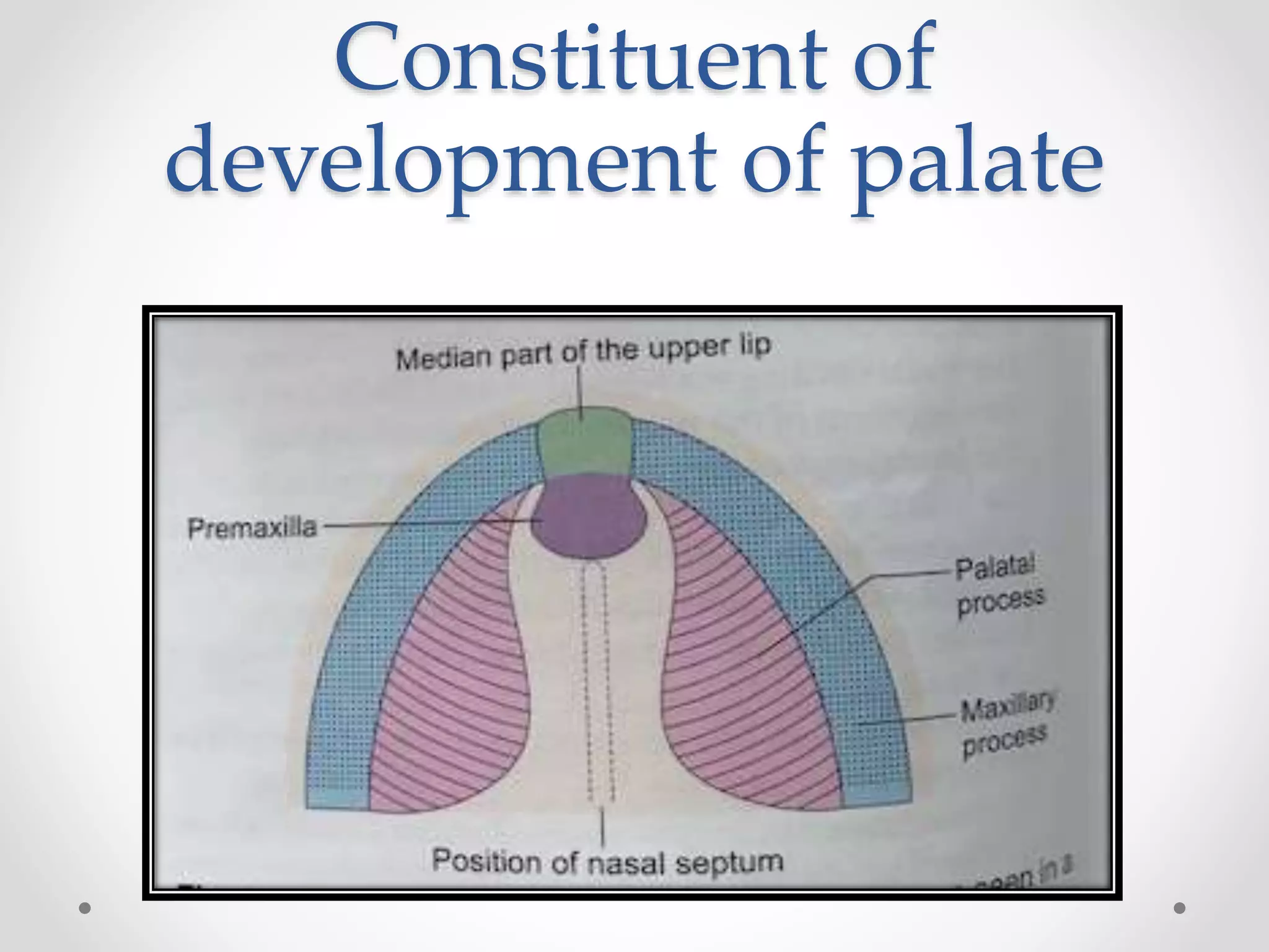 hard and soft palate in prosthodontics | PPTX