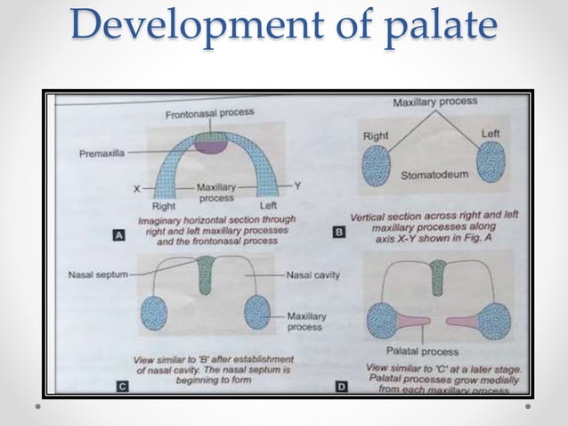 hard and soft palate in prosthodontics | PPTX