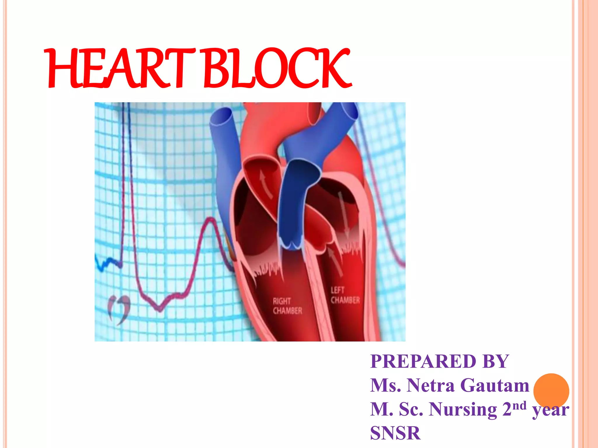 Heart block | PPTX