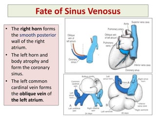 Final heart development.ppt