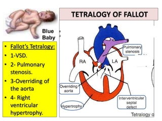 Final heart development.ppt