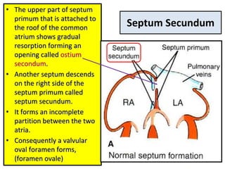 Final heart development.pptx