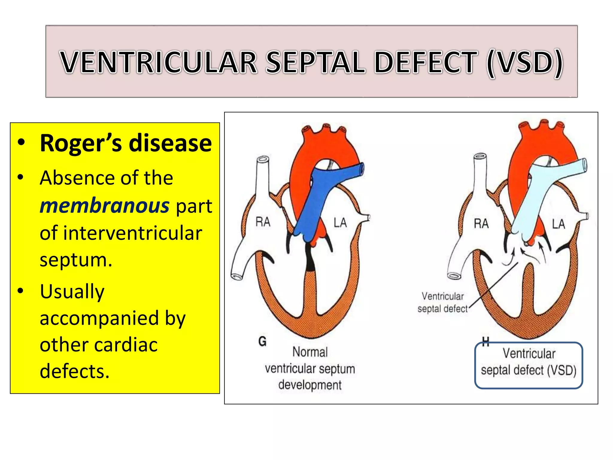 Final heart development.pptx