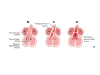 Final heart development.pptx