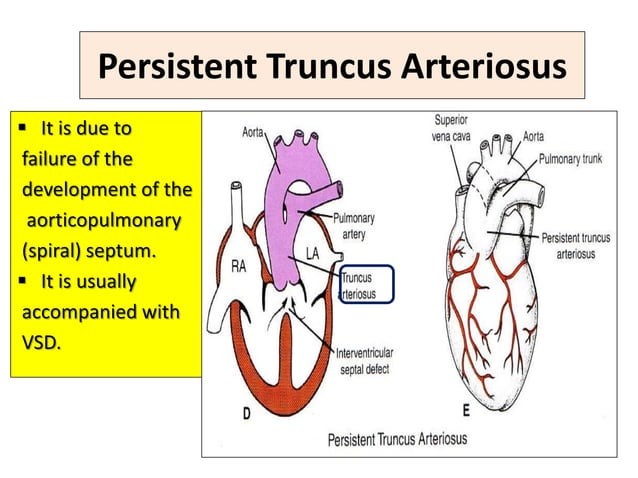 Final heart development.pptx