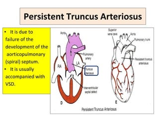 development of heart.pptx