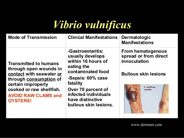 Final housestaff opportunistic infections lecture