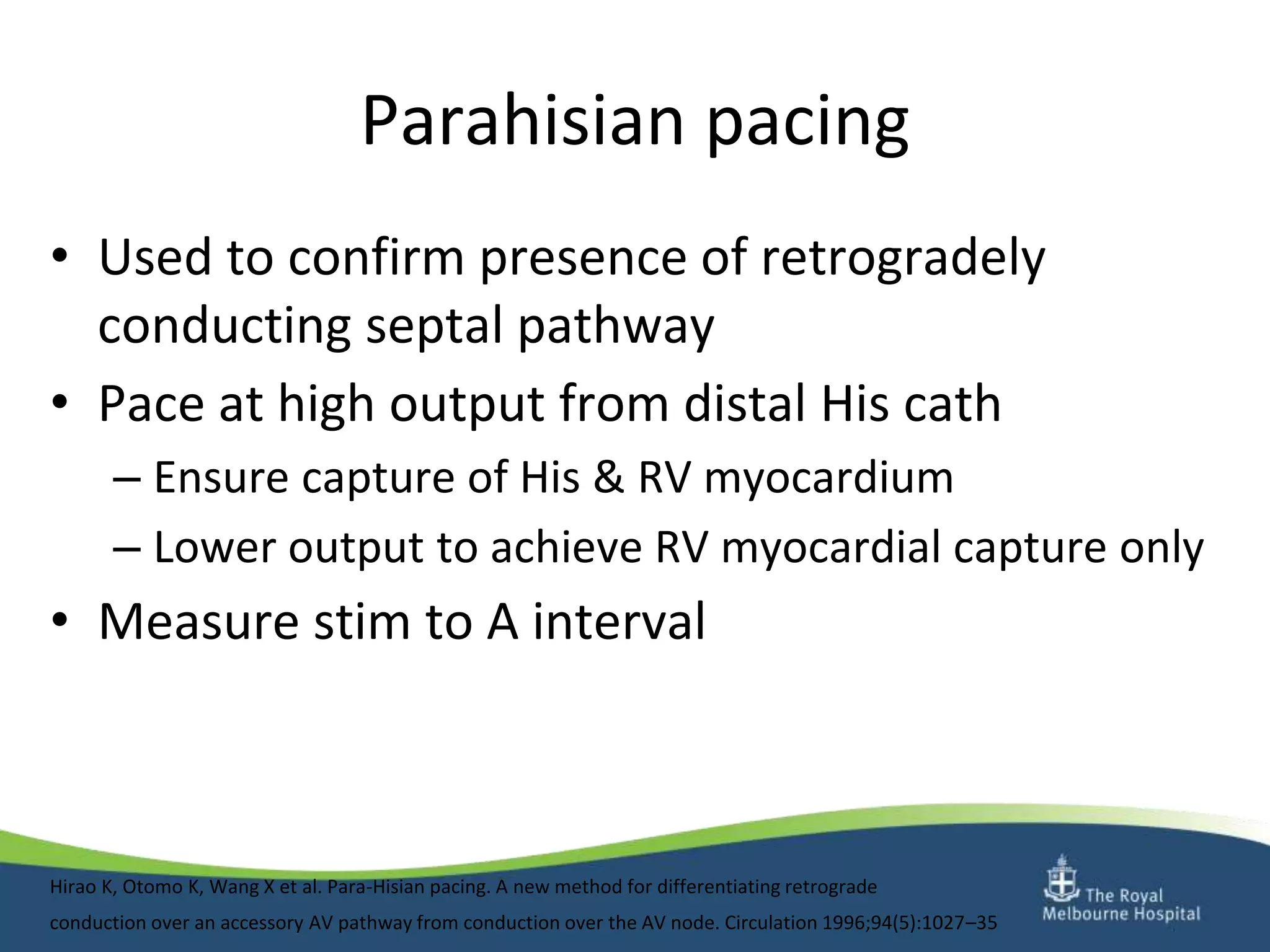 How to perform an ep study and diagnostic pacing during sinus rhythm | PPTX