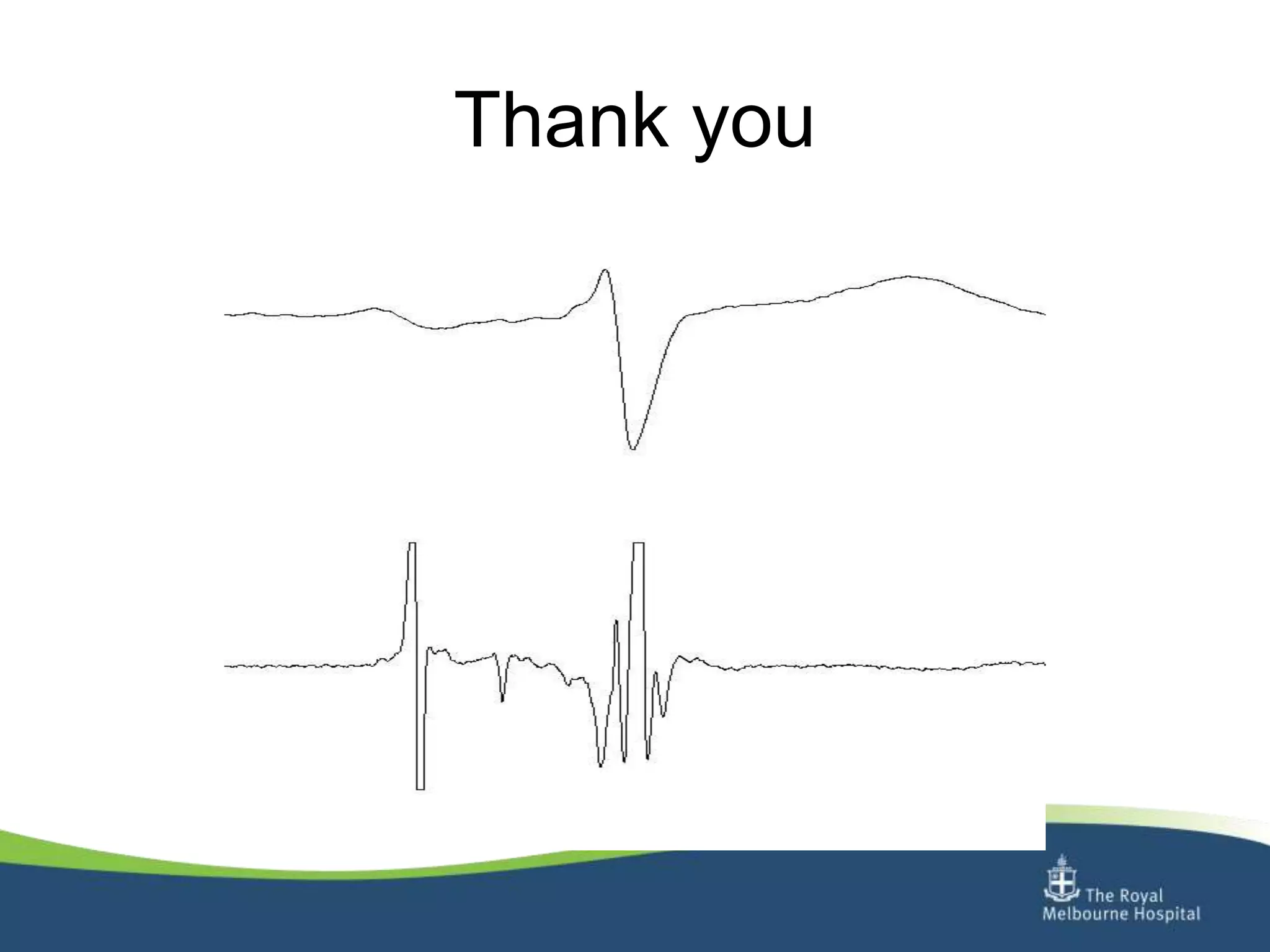 How to perform an ep study and diagnostic pacing during sinus rhythm | PPTX
