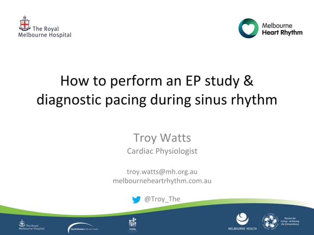 How to perform an ep study and diagnostic pacing during sinus rhythm | PPTX