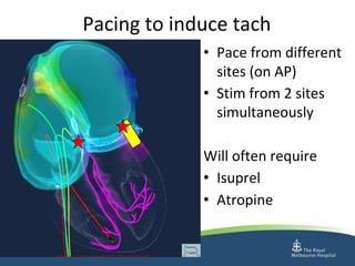 How to perform an ep study and diagnostic pacing during sinus rhythm | PPTX