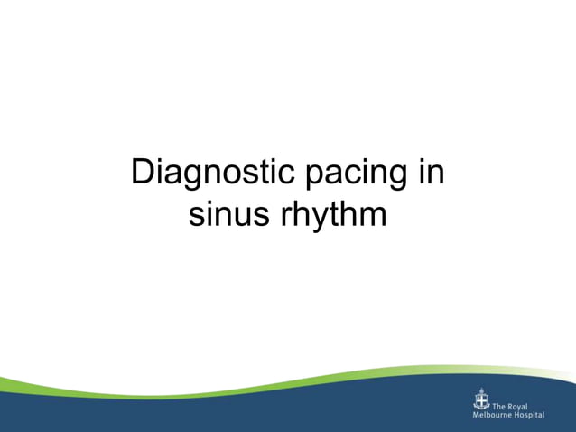 How to perform an ep study and diagnostic pacing during sinus rhythm | PPTX
