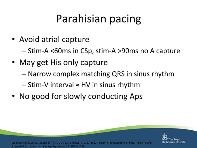 How to perform an ep study and diagnostic pacing during sinus rhythm | PPTX