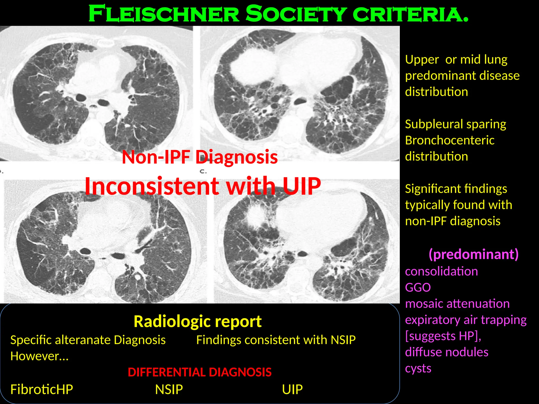 HRCT SCAN IN INTERSTITIAL LUNG DISEASE .pptx