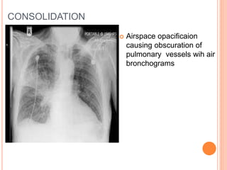 final image of week dharu1.pptx