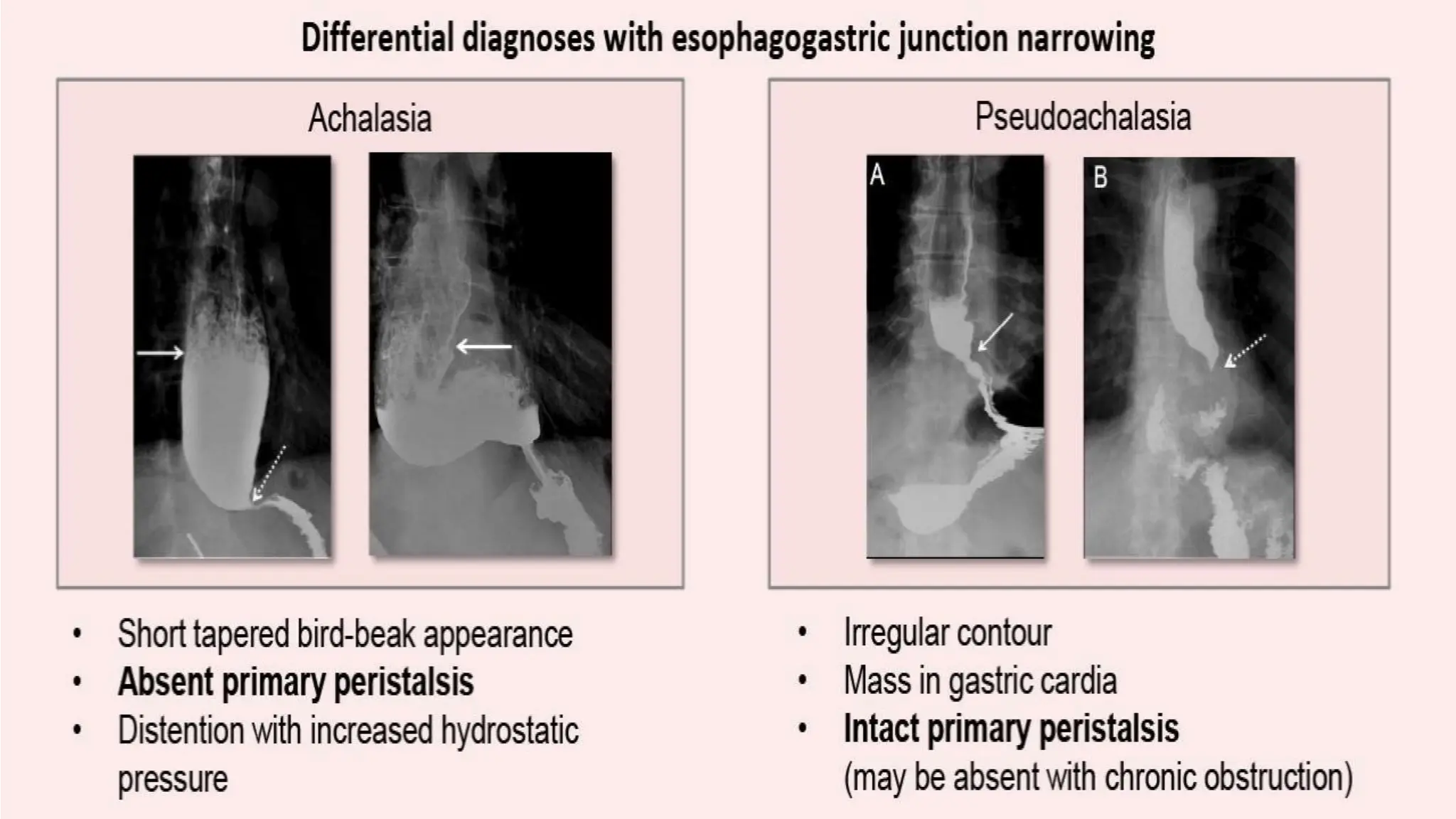 Imaging review Gastrointestinal motility disorders.pptx