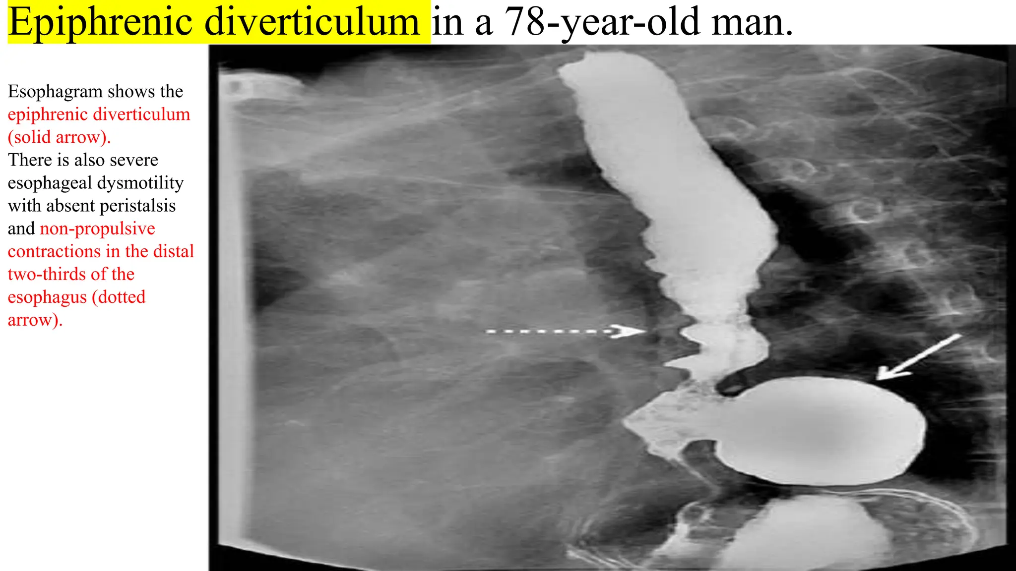 Imaging review Gastrointestinal motility disorders.pptx
