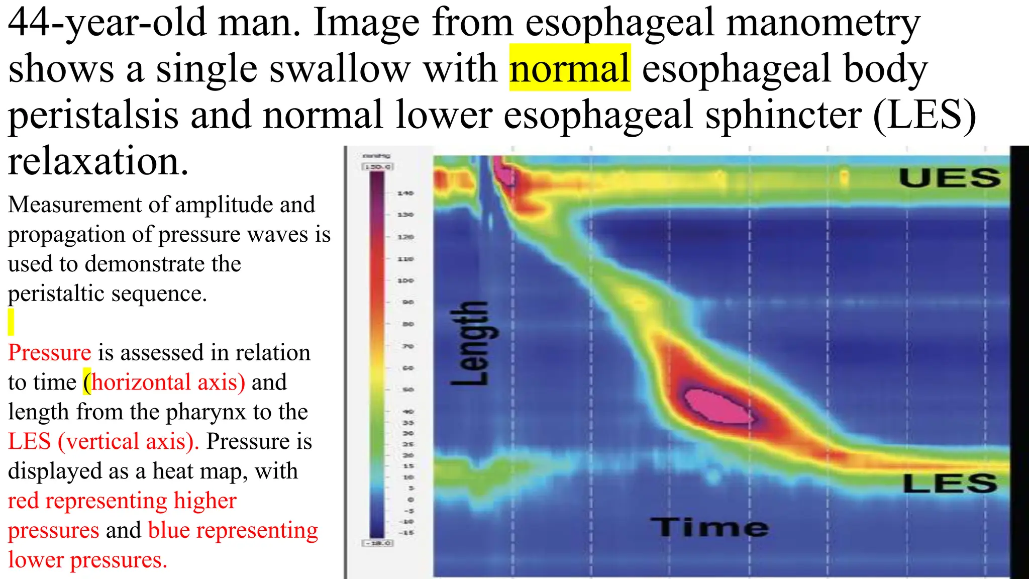 Imaging review Gastrointestinal motility disorders.pptx
