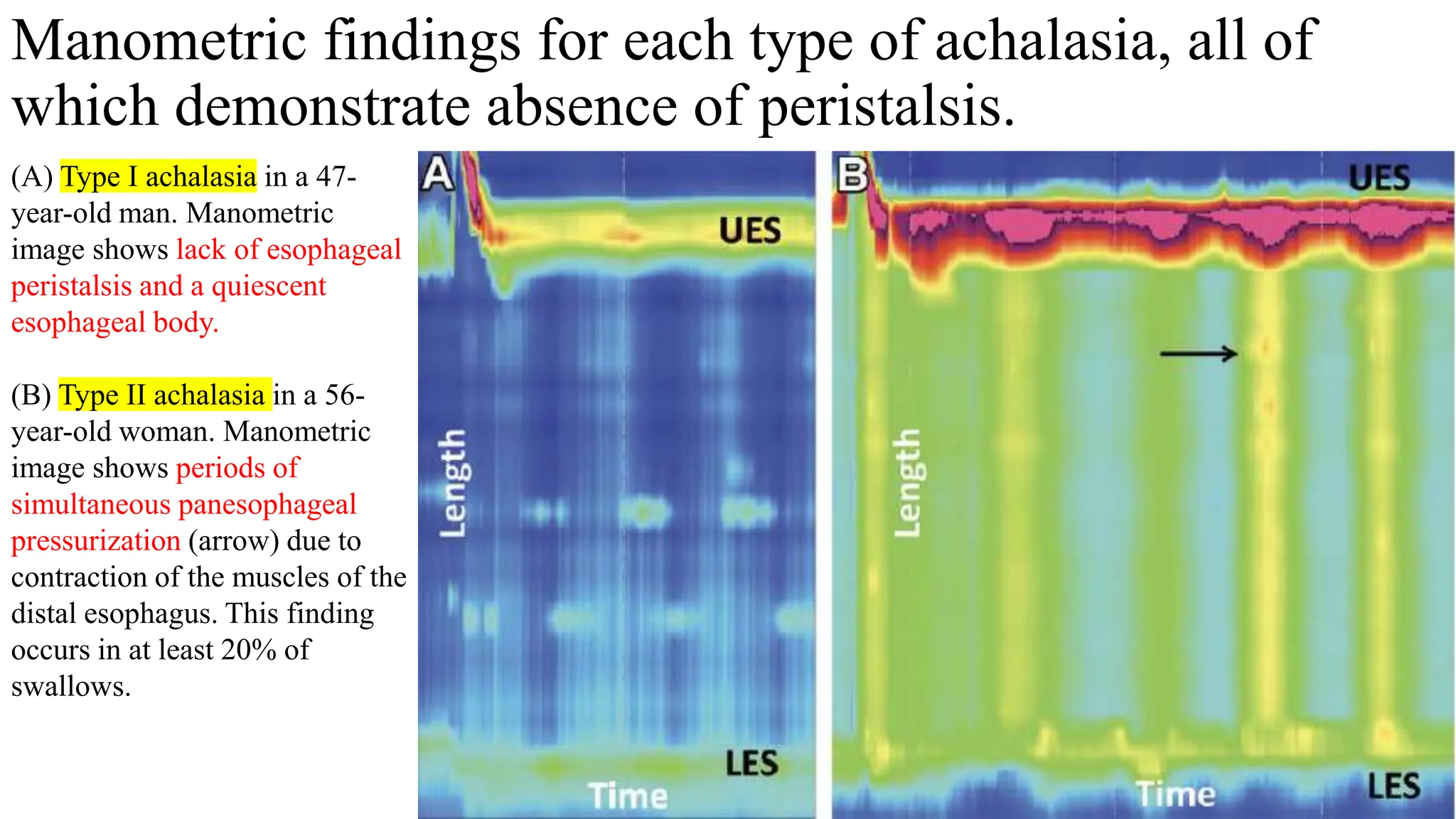 Imaging review Gastrointestinal motility disorders.pptx