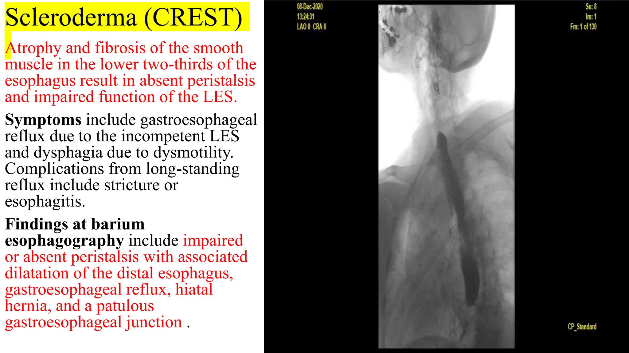 Imaging review Gastrointestinal motility disorders.pptx