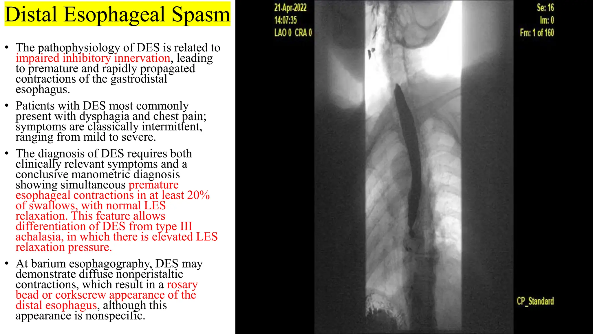 Imaging review Gastrointestinal motility disorders.pptx