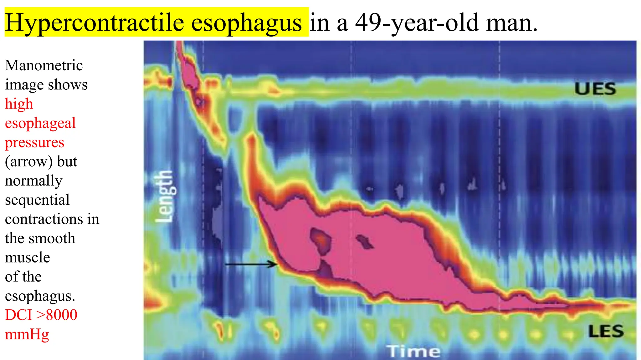 Imaging review Gastrointestinal motility disorders.pptx