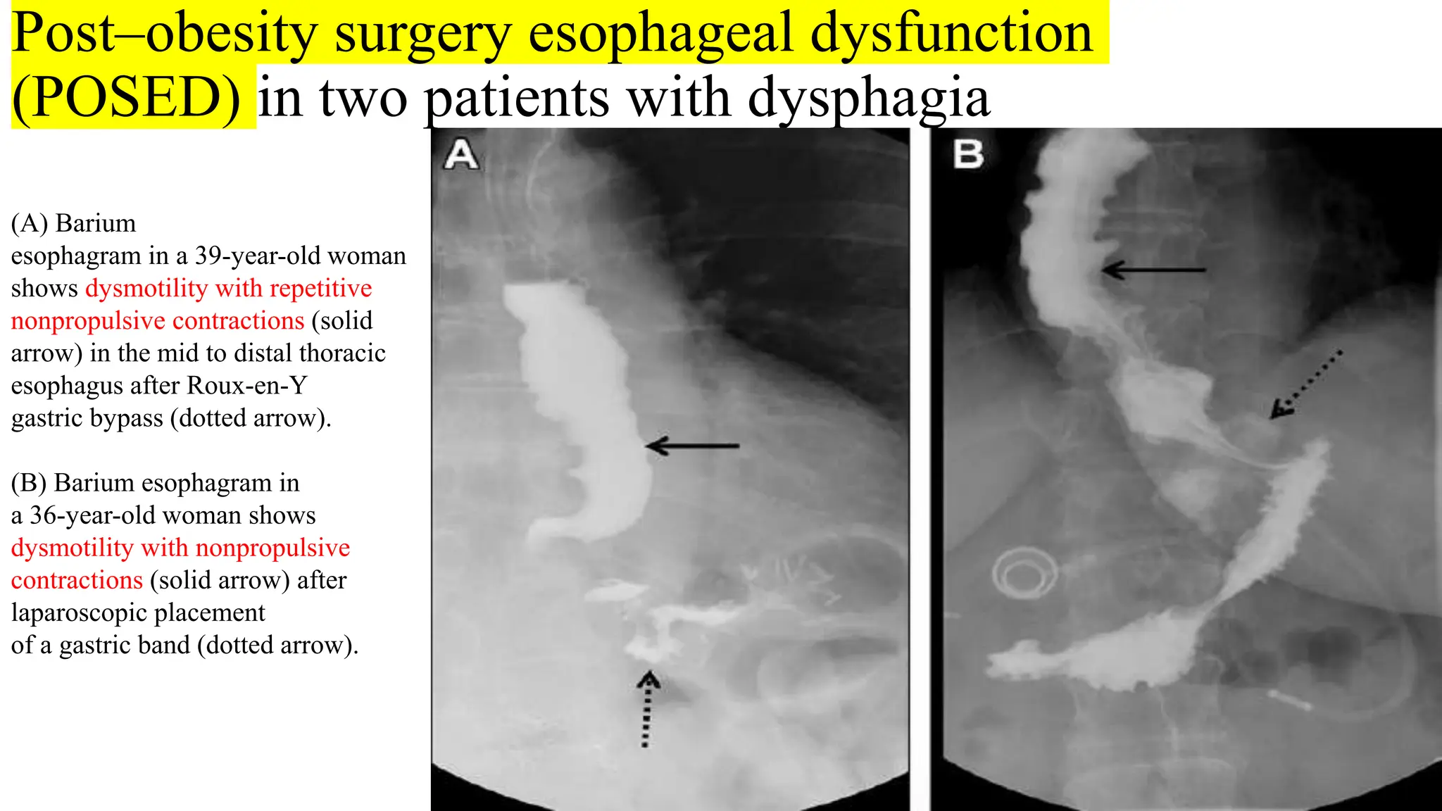 Imaging review Gastrointestinal motility disorders.pptx