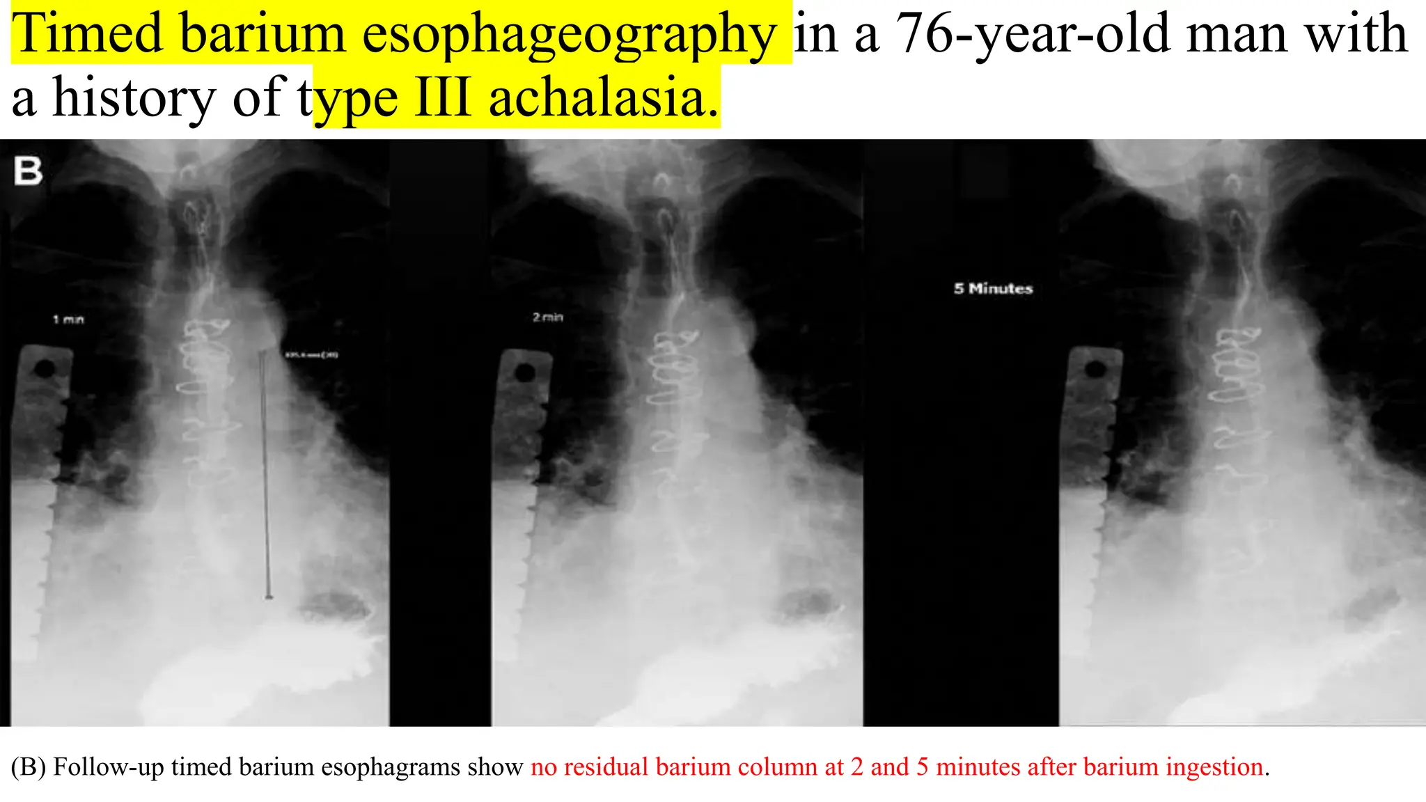 Imaging review Gastrointestinal motility disorders.pptx